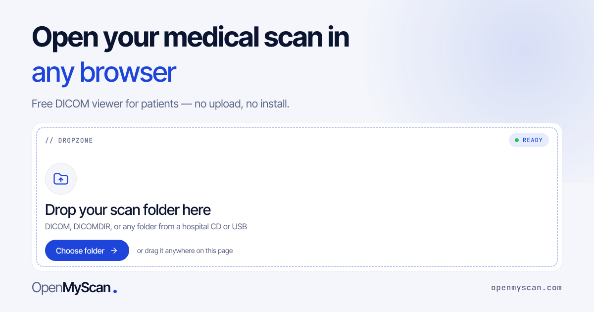 Free Online DICOM Viewer — No Download | OpenMyScan